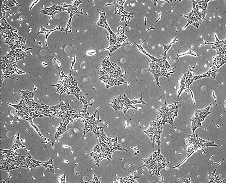 Línea de Investigación del Dr. Alfredo Lorenzo - Instituto Ferreyra